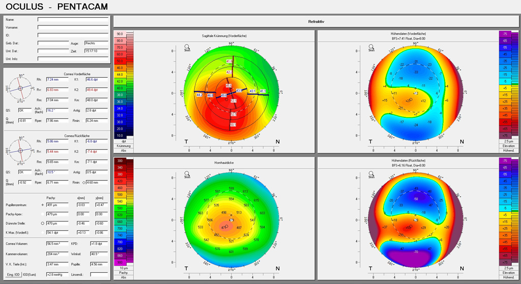 Keratokonus - Argus Augen MVZ GmbH